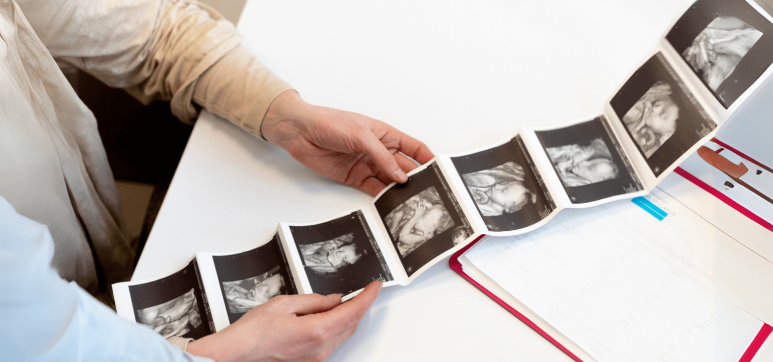 Essential Guide to the Anomaly Scan: What to Expect and Understand ...